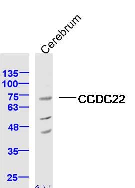 CCDC22 Polyclonal Antibody - Purified Rabbit Polyclonal Antibody (Pab ...