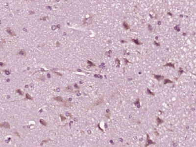 CWH43 Polyclonal Antibody - Purified Rabbit Polyclonal Antibody (Pab ...