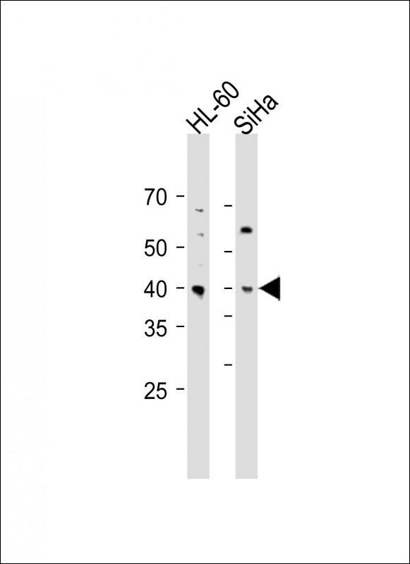 G6PC Antibody (Center) - Affinity Purified Rabbit Polyclonal Antibody ...
