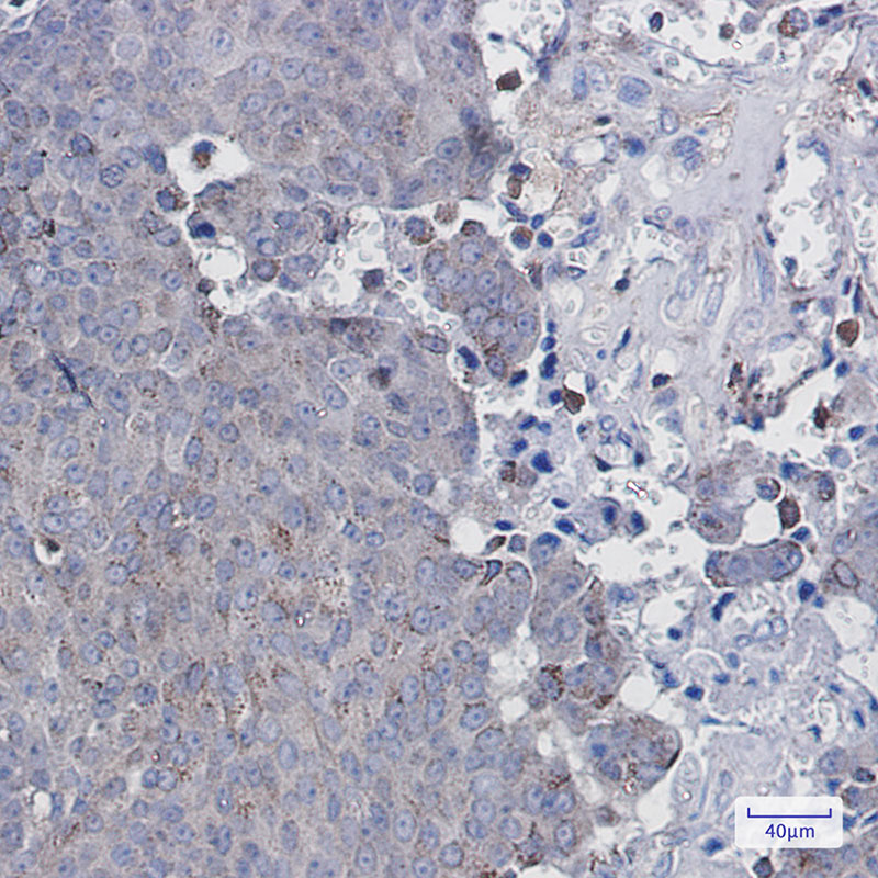 Adipose Triglyceride Lipase Rabbit Mab Wb Ihc P Ip Buy Now