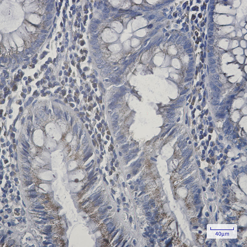AGPS Rabbit mAb - WB, IHC-P, IP - Buy Now!