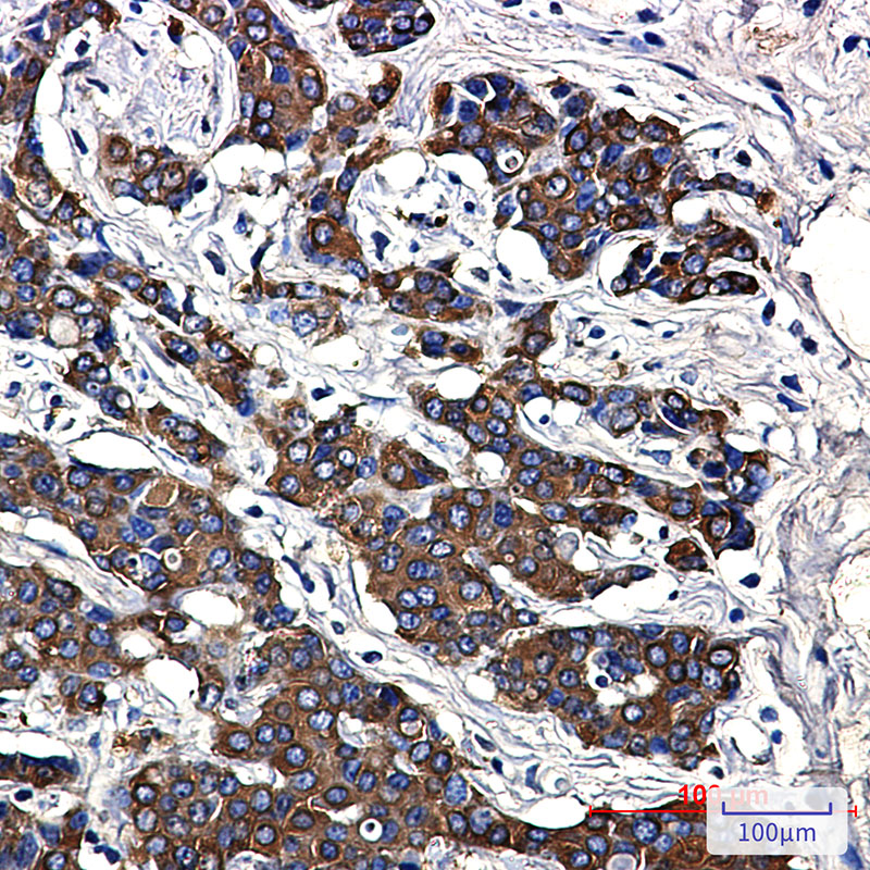 Hsp27 Rabbit mAb - WB, IHC-P - Buy Now!