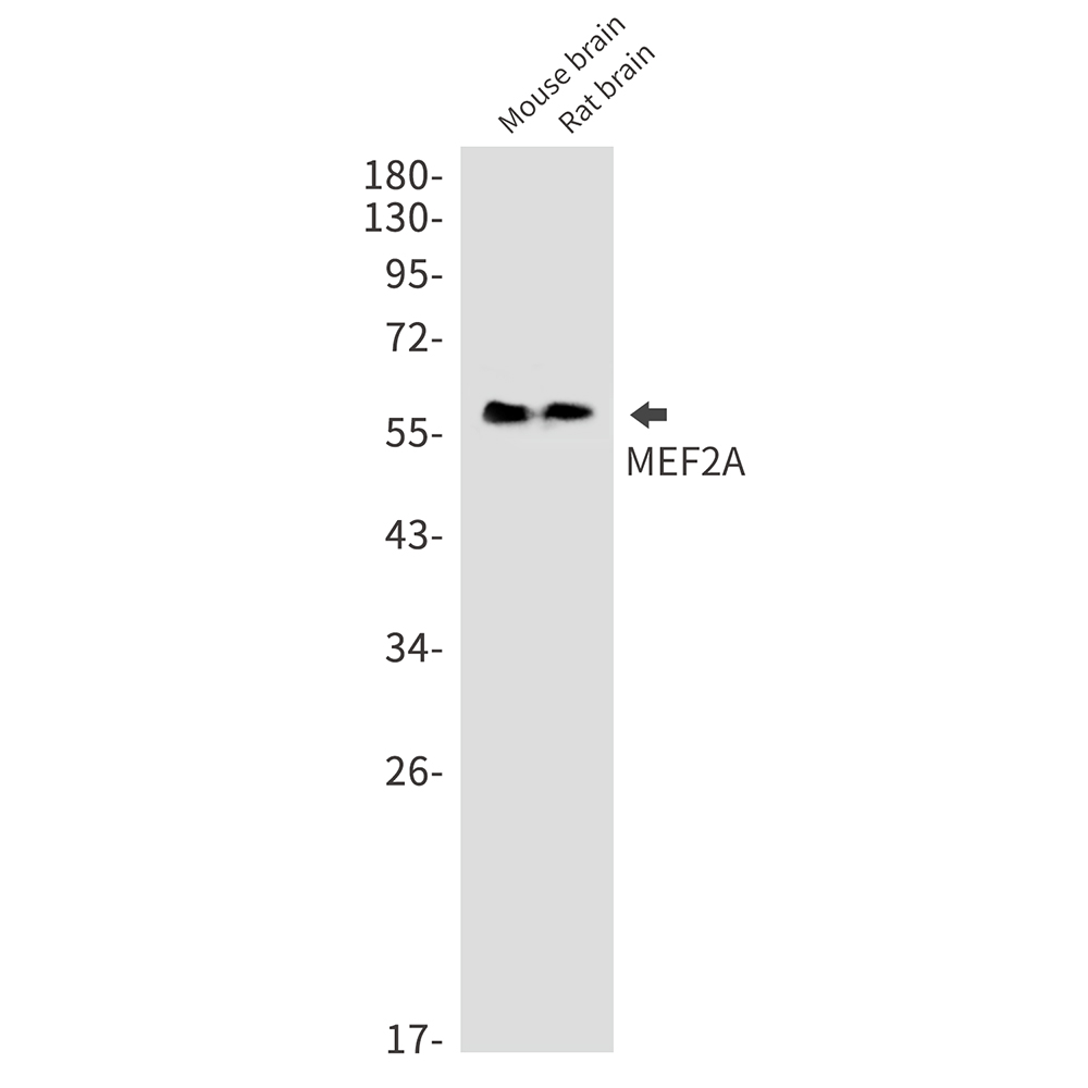 MEF2A Rabbit mAb - WB, ICC/IF - Buy Now!