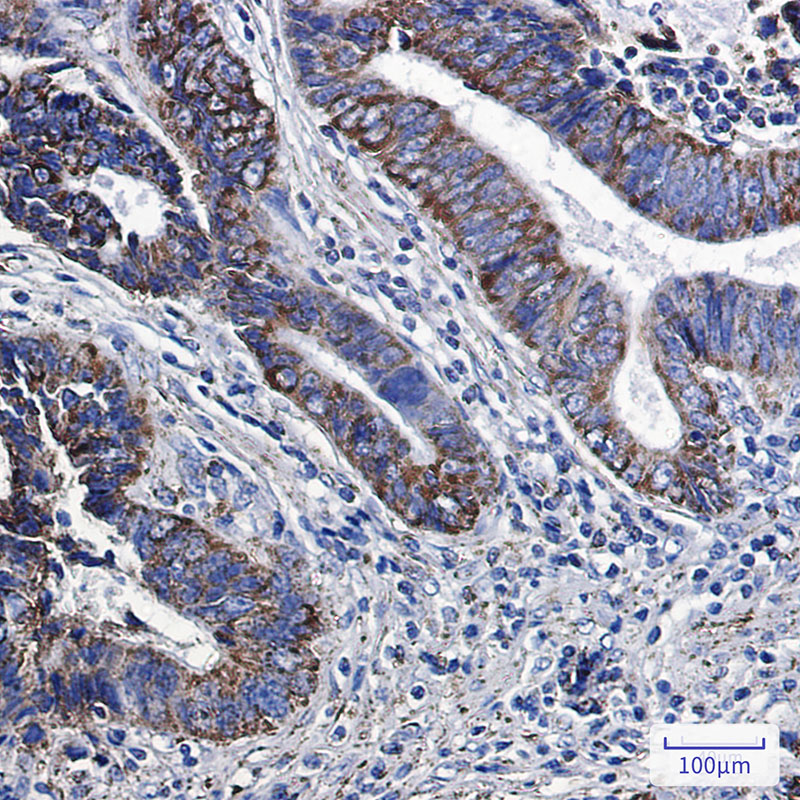 MGST3 Rabbit mAb - WB, IHC-P, IP - Buy Now!