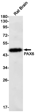 PAX6 Rabbit mAb - WB - Buy Now!