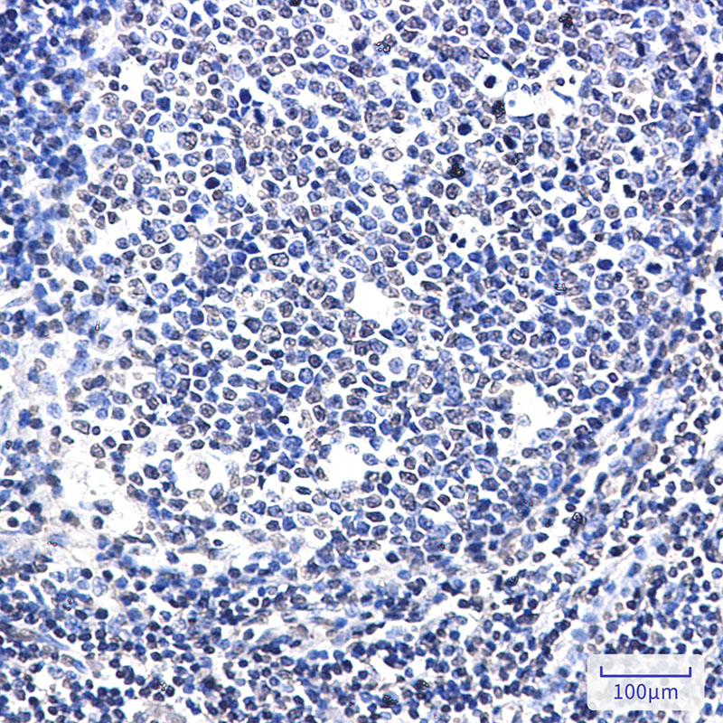 SATB1 Rabbit mAb - WB, IHC-P, IP - Buy Now!