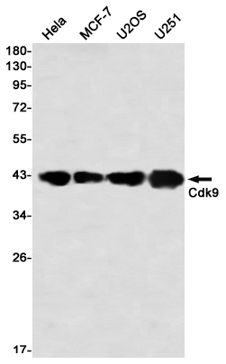 CDK9 Rabbit mAb - WB, IP, ICC - Buy Now!