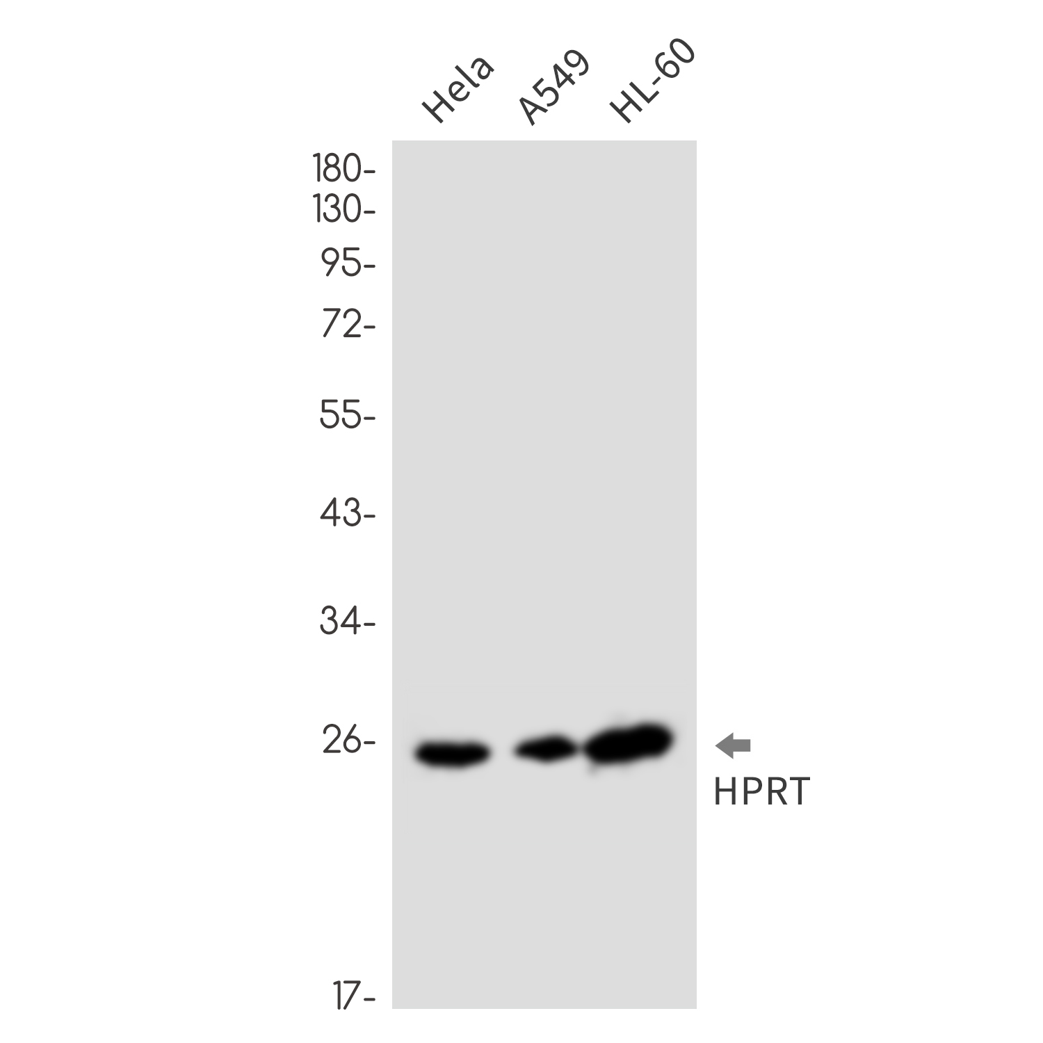 HPRT Rabbit mAb - WB, IP - Buy Now!