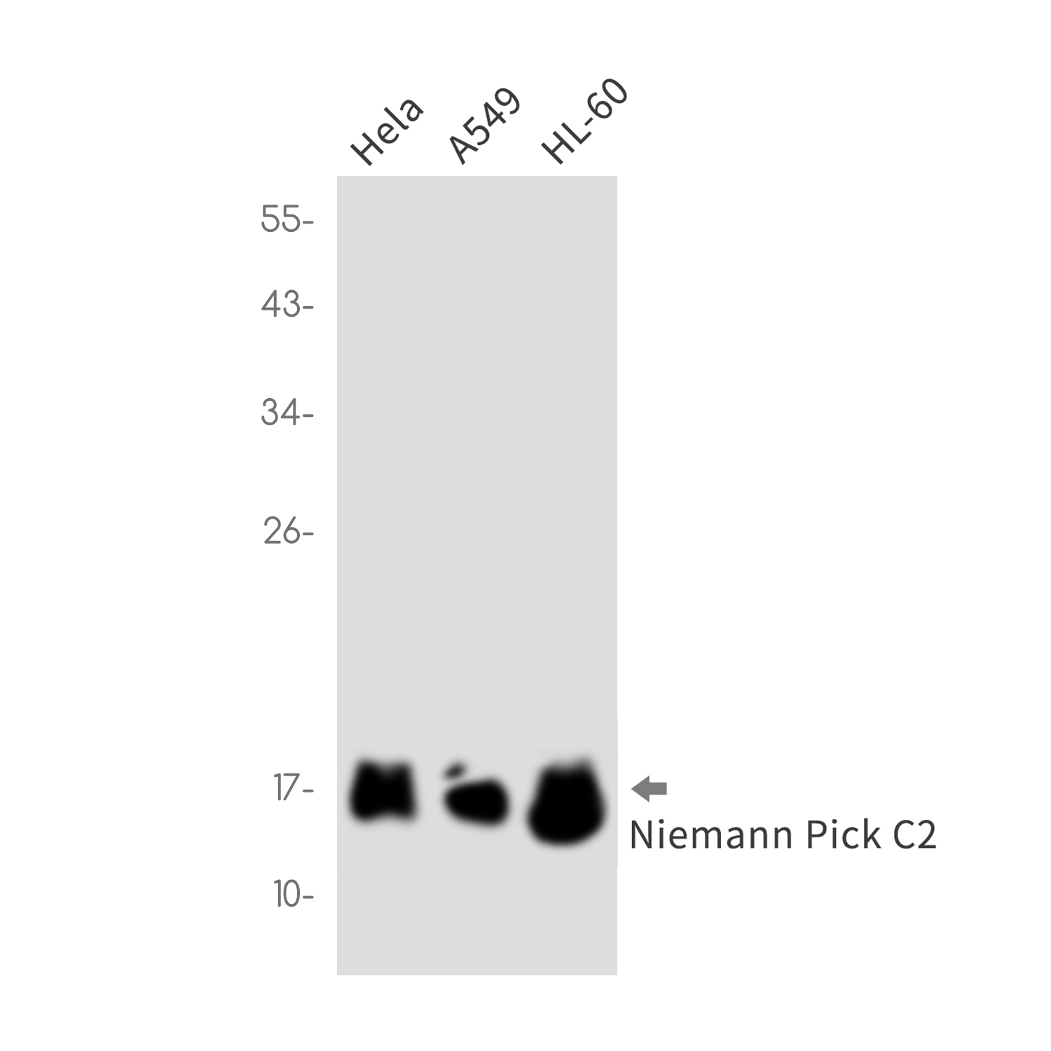 Niemann Pick C2 Rabbit mAb - WB, IHC-P, IHC-F, ICC - Buy Now!