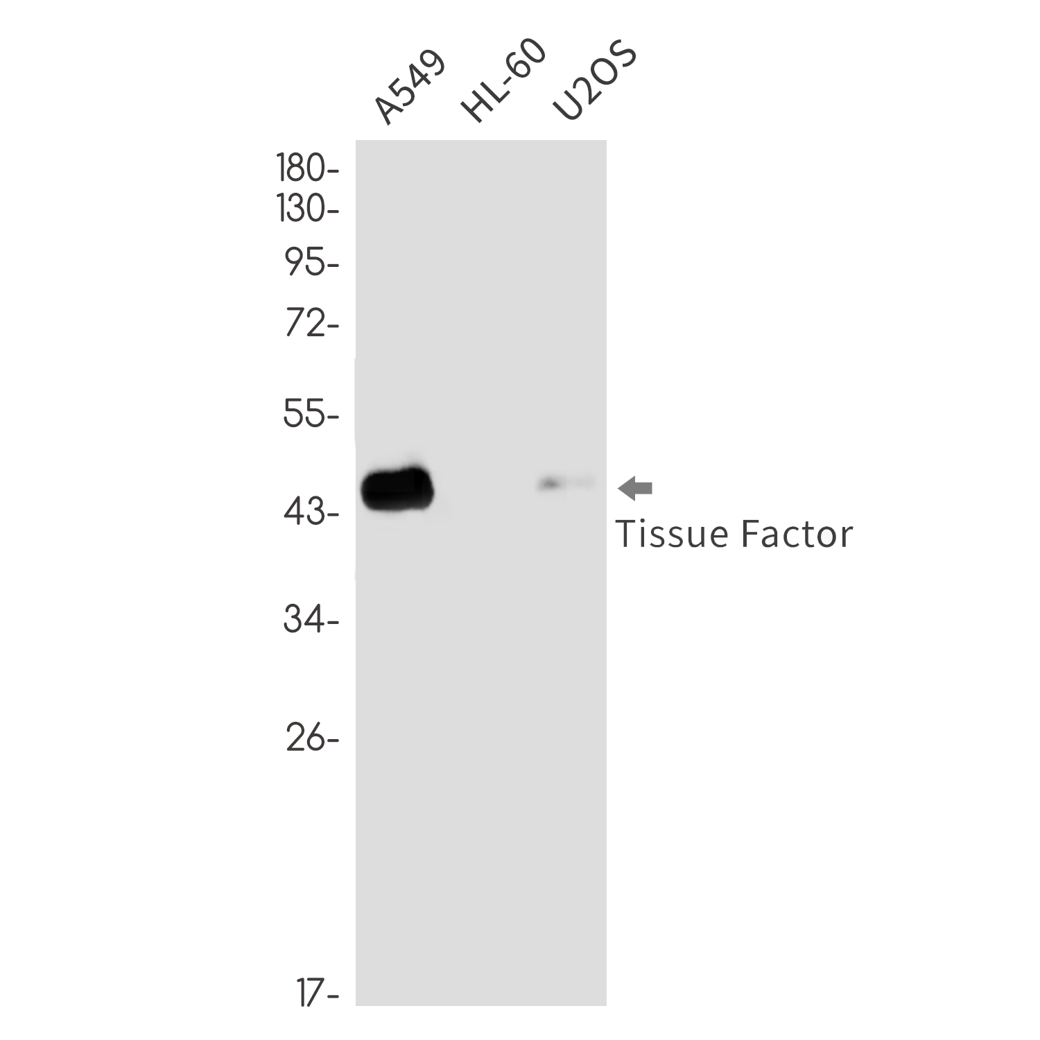 Tissue Factor Rabbit mAb - WB, IHC-P - Buy Now!