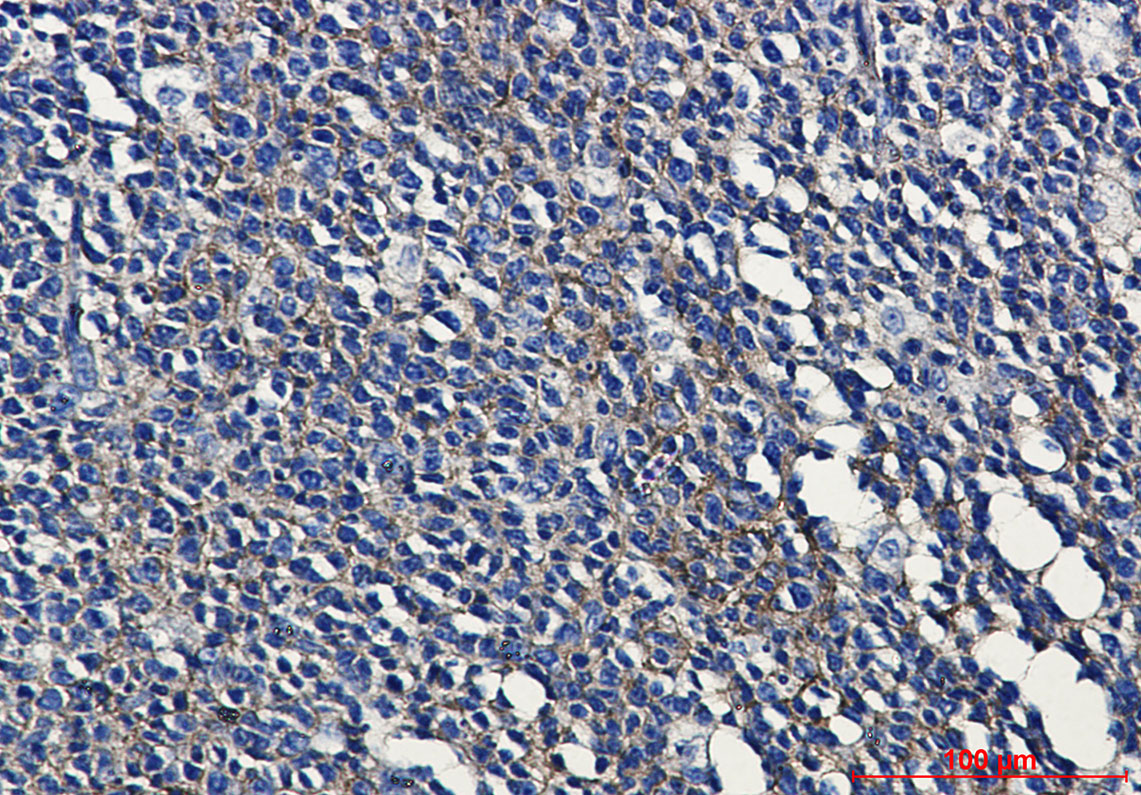 MHC Class I Rabbit mAb - WB, IHC-P - Buy Now!