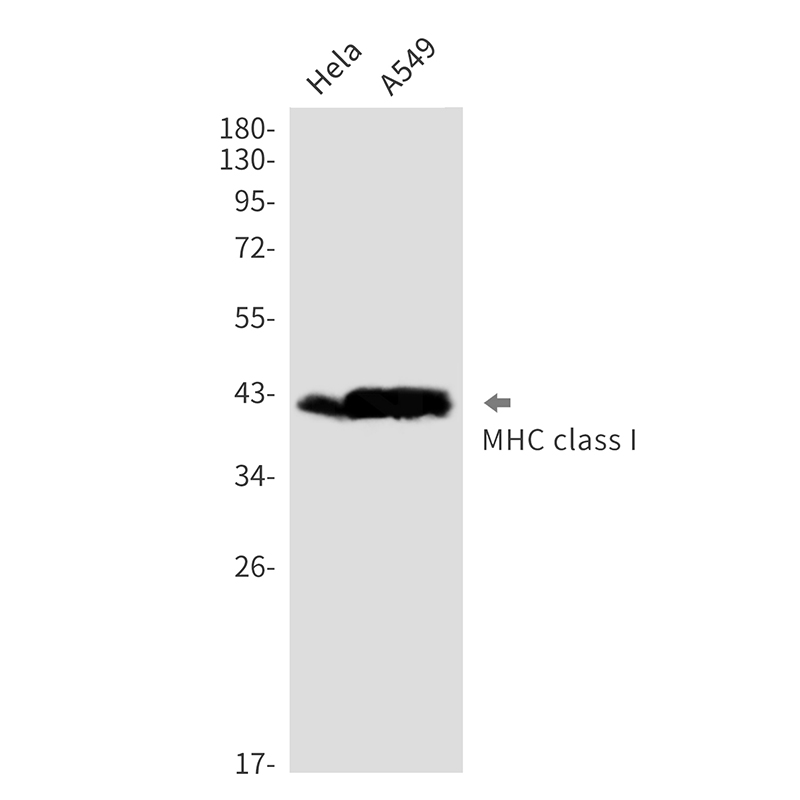 MHC Class I Rabbit mAb - WB, IHC-P - Buy Now!