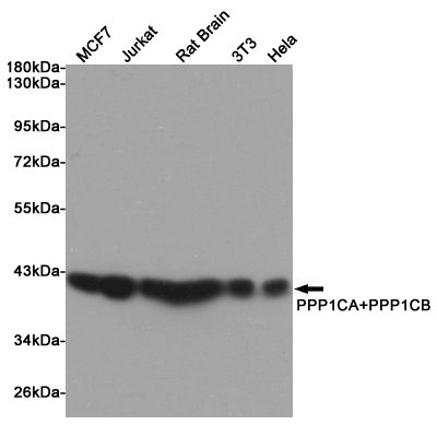 PP1C alpha/beta Rabbit mAb - WB, IHC-P, IP, ICC/IF - Buy Now!