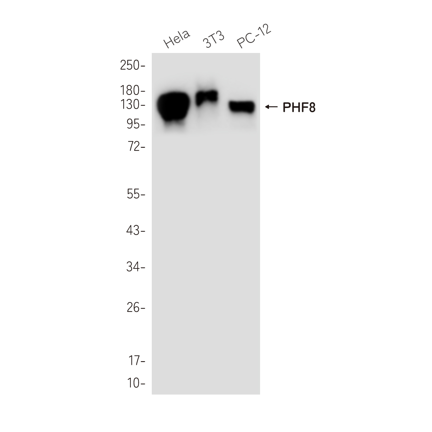 PHF8 Rabbit mAb - WB, IP, ICC - Buy Now!