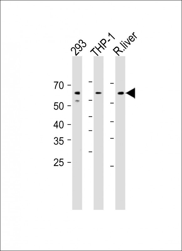 GPC6 Antibody (C-term) - Purified Rabbit Polyclonal Antibody (Pab) WB ...