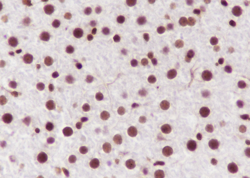 Ubiquityl-Histone H2B (Lys120) Recombinant Mouse mAb - Ubiquityl ...